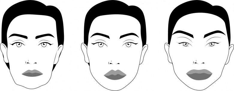 ¿Qué es el cada vez más común Facial Overfilled Syndrome? - Expertos en ...