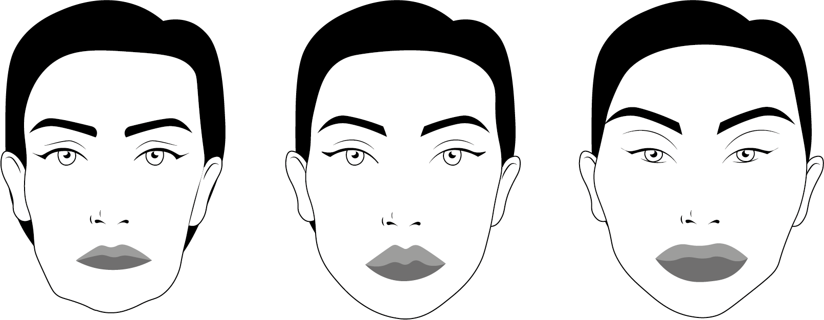 ¿Qué es el cada vez más común Facial Overfilled Syndrome? - Expertos en ...